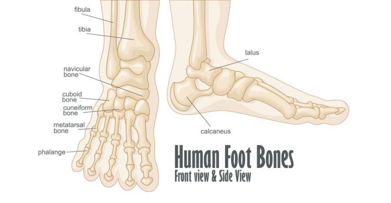 Broken Foot & Foot Fracture Ultimate Guide:Causes, Symptoms, Recovery